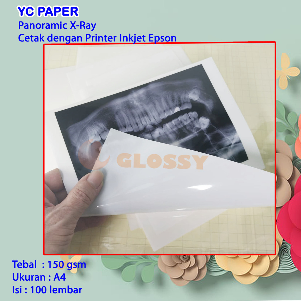 Jual YC Paper Panoramic X-Ray Cetak dengan Printer Inkjet Epson ...