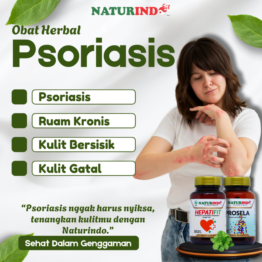 Jual Obat Gatal Kulit Psoriasis Ampuh Autoimun Gatel Alergi Eksim Kulit ...