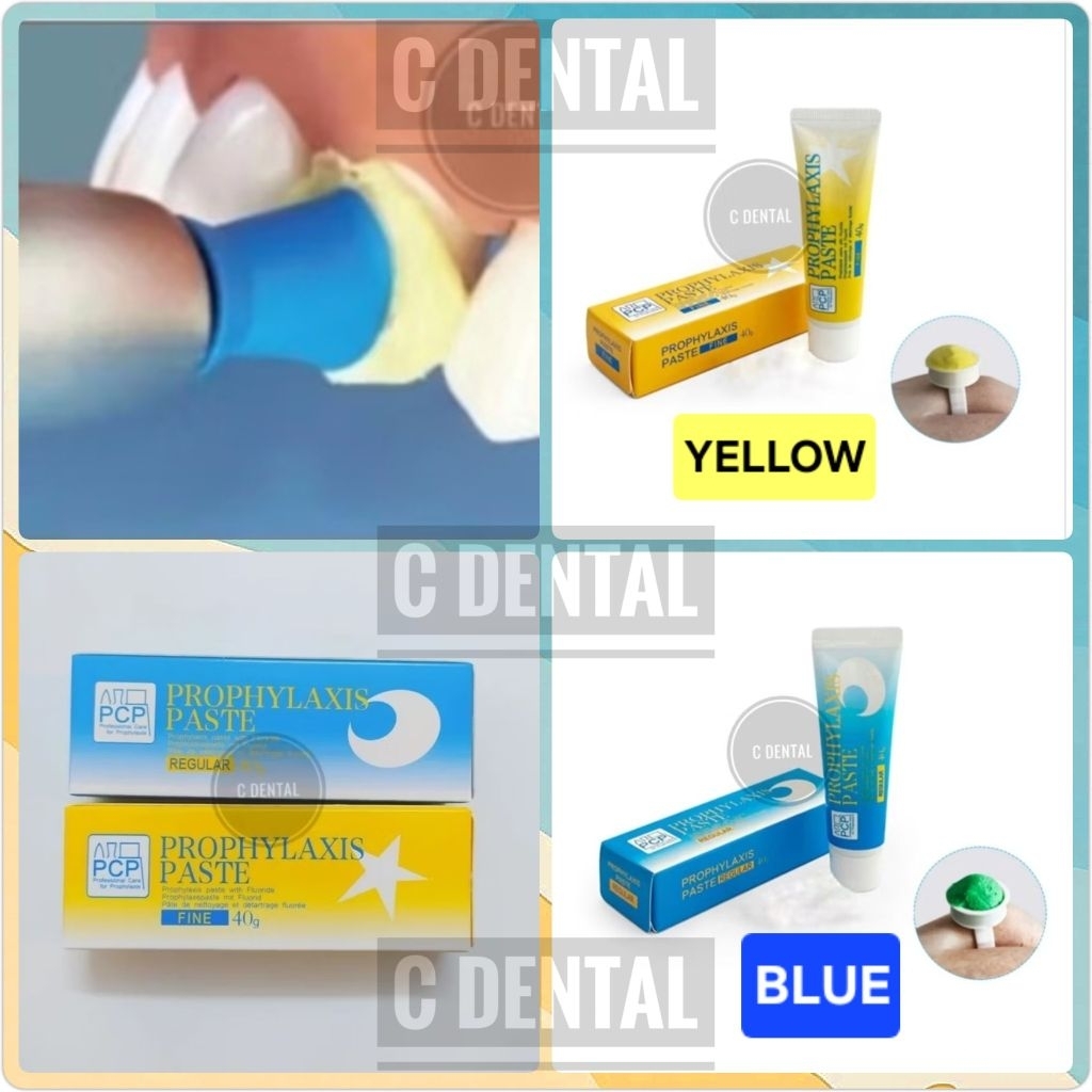 Jual [40 Gram] Dental Pasta Pumice Polishing With Fluoride Watery Foam ...