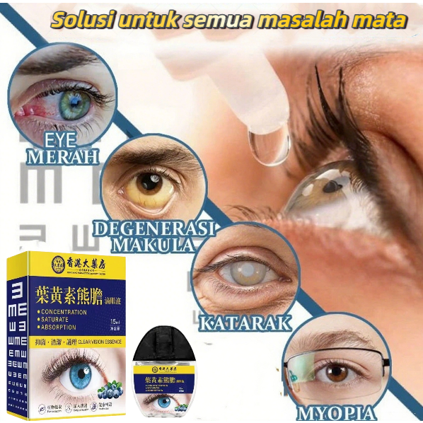 Jual Obat Tetes Mata Obat Mata Katarak Eye Drop Obat Mata Buram Obat ...