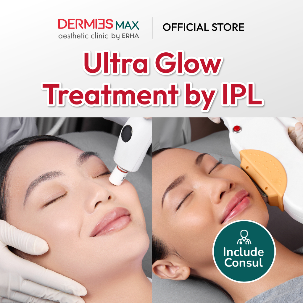 Jual Dermies Ultra Glow Treatment by IPL | Shopee Indonesia