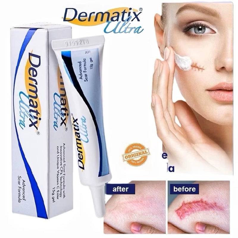 Jual Dermatix Ultra 15gr Original untuk Bekas Luka Efektif untuk Luka ...