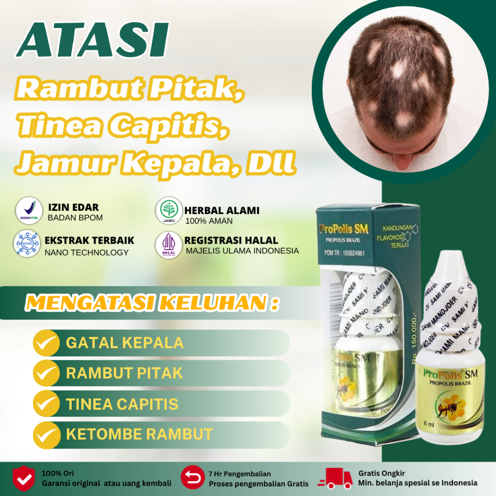 Jual Obat Penumbuh Rambut, Penumbuh Rambut Cepat Serum Penumbuh Rambut ...