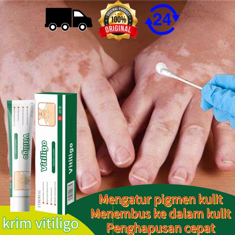 Jual COD Salep Vitiligo 20g Membantu Pertumbuhan Melanin Penyakit Kulit ...
