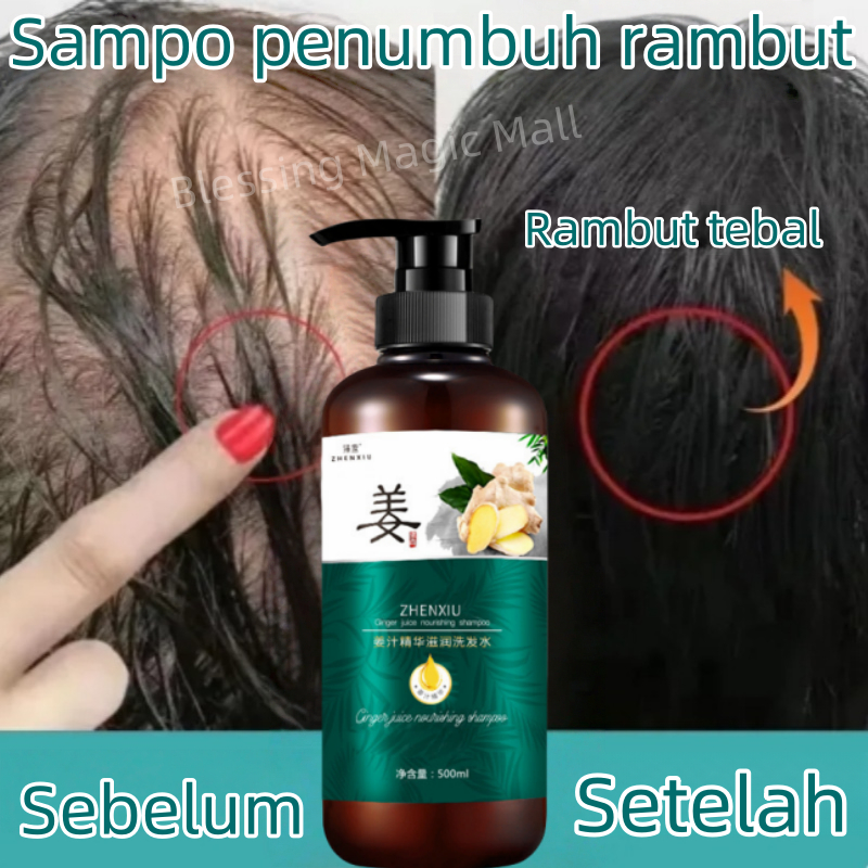 Jual sampo penumbuh rambut cepat perawatan rambut rontok shampo rambut ...