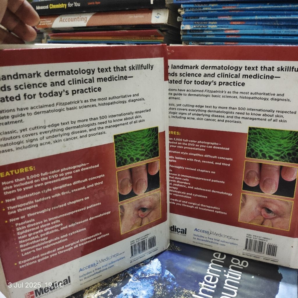 Jual BUKU FITZPATRICK'S DERMATOLOGY IN GENERAL MEDICINE EIGHTH EDITION ...