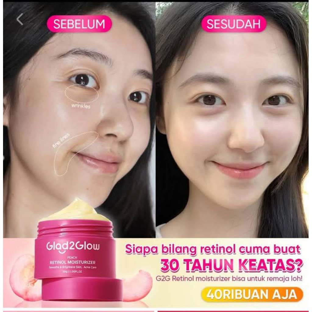 Jual retinol glad 2 glow /g2g | Shopee Indonesia