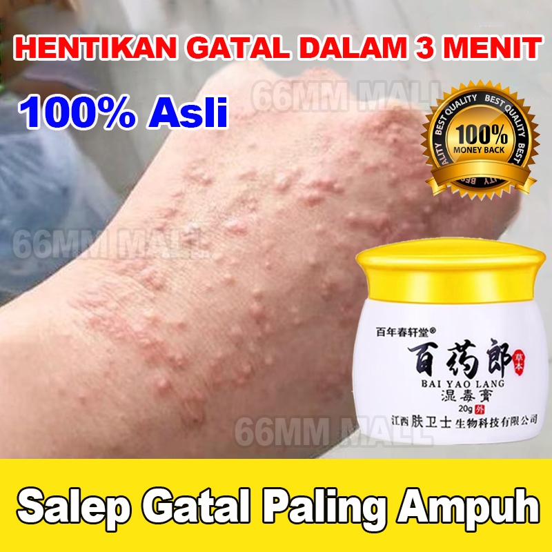 Jual Salep Eksim Kering dan Gatal Salep Gatal China Paling Ampuh Obat ...