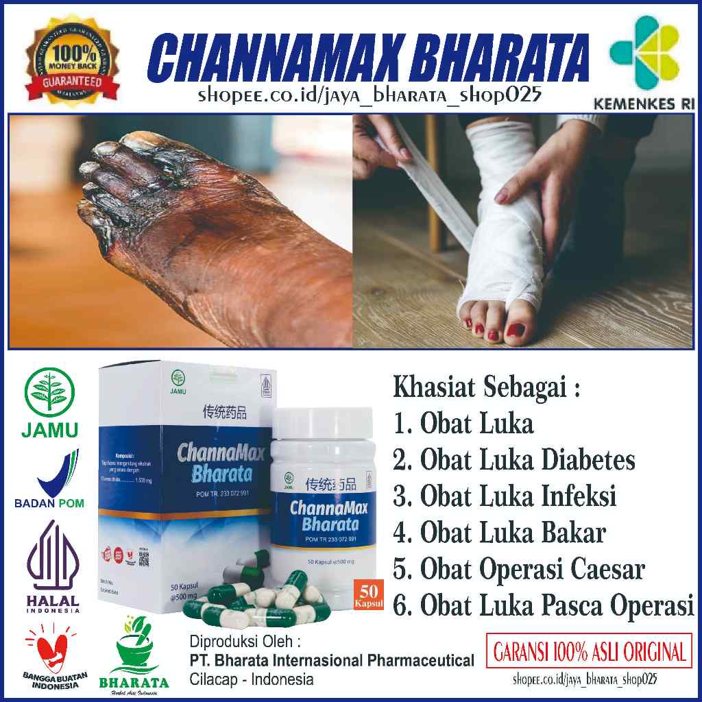 Jual Obat Luka Ampuh CHANNAMAX BHARATA Obat Luka Diabetes, Obat Luka ...
