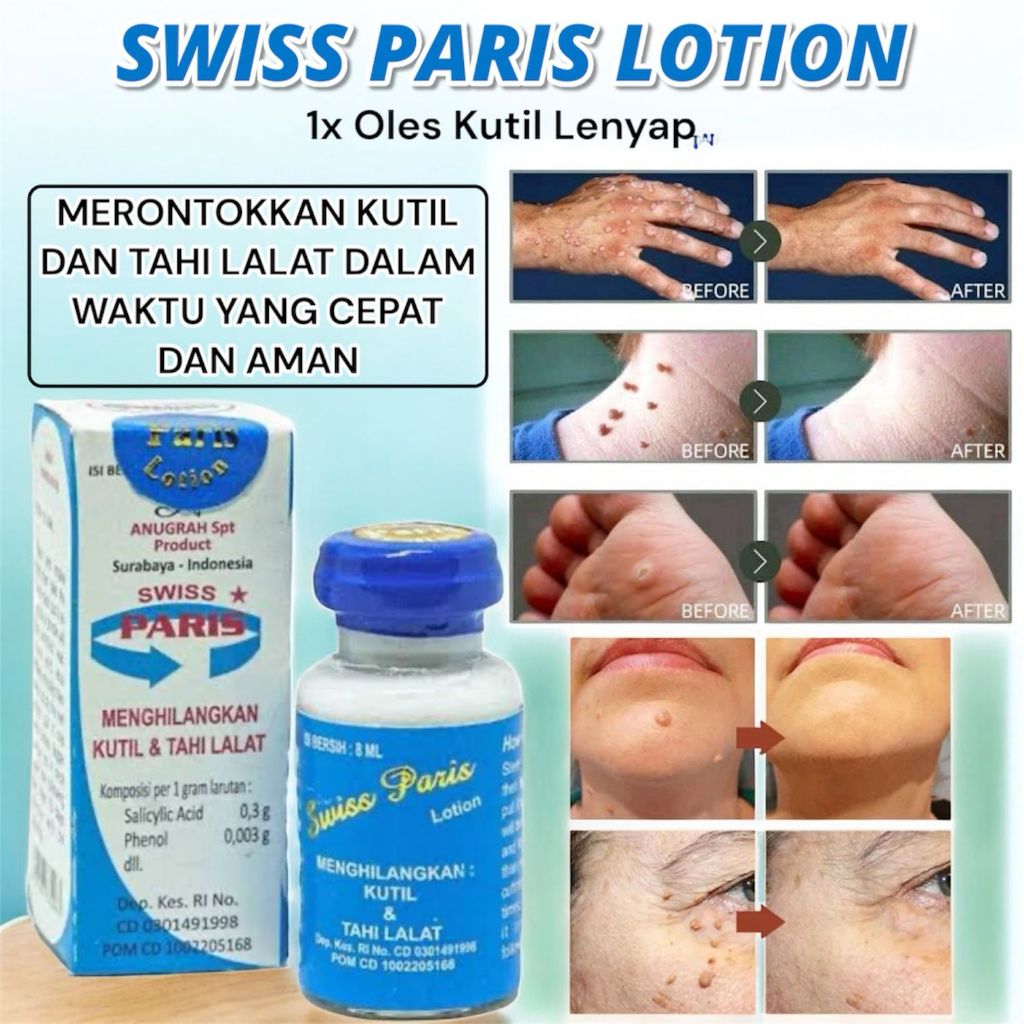 Jual SWISS PARIS LOTION PENGHILANG TAHI LALAT DAN KUTIL ORIGINAL BPOM ...