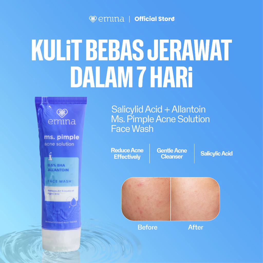 Jual EMINA Ms. Pimple Acne Solution Face Wash 50ml | Shopee Indonesia