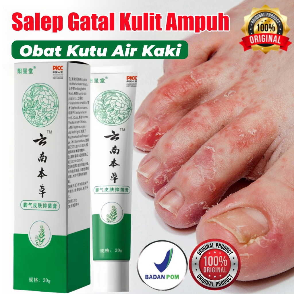 Jual Obat Kutu Air Kaki Salep Gatal Kulit Antibakteri Obat Kurap Ampuh ...