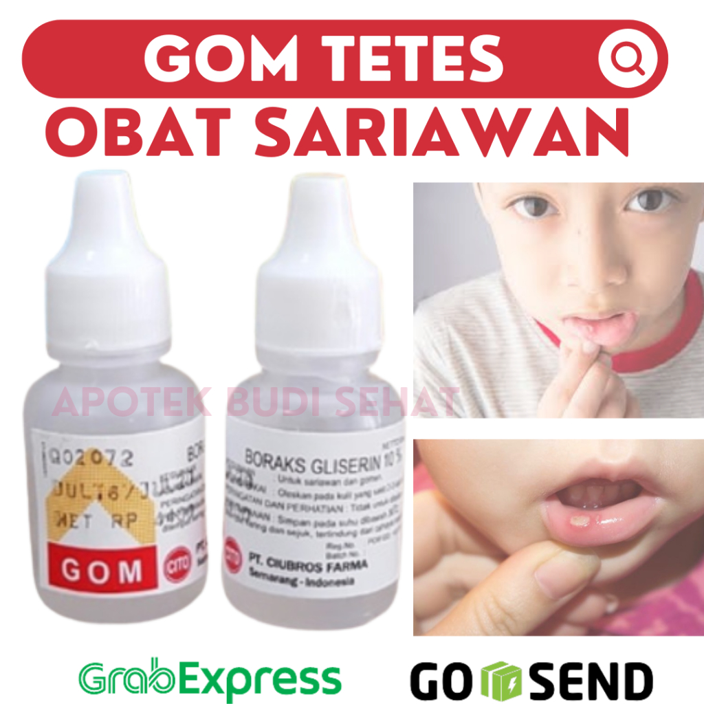 Jual CITO GOM Borax Glycerin Obat Sariawan Anak untuk Radang Gusi, Luka ...