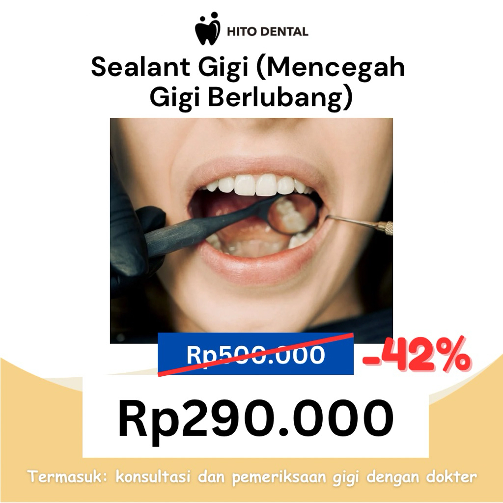 Jual Sealant Gigi (per gigi) + Konsultasi Dokter Gigi + Pemeriksaan ...