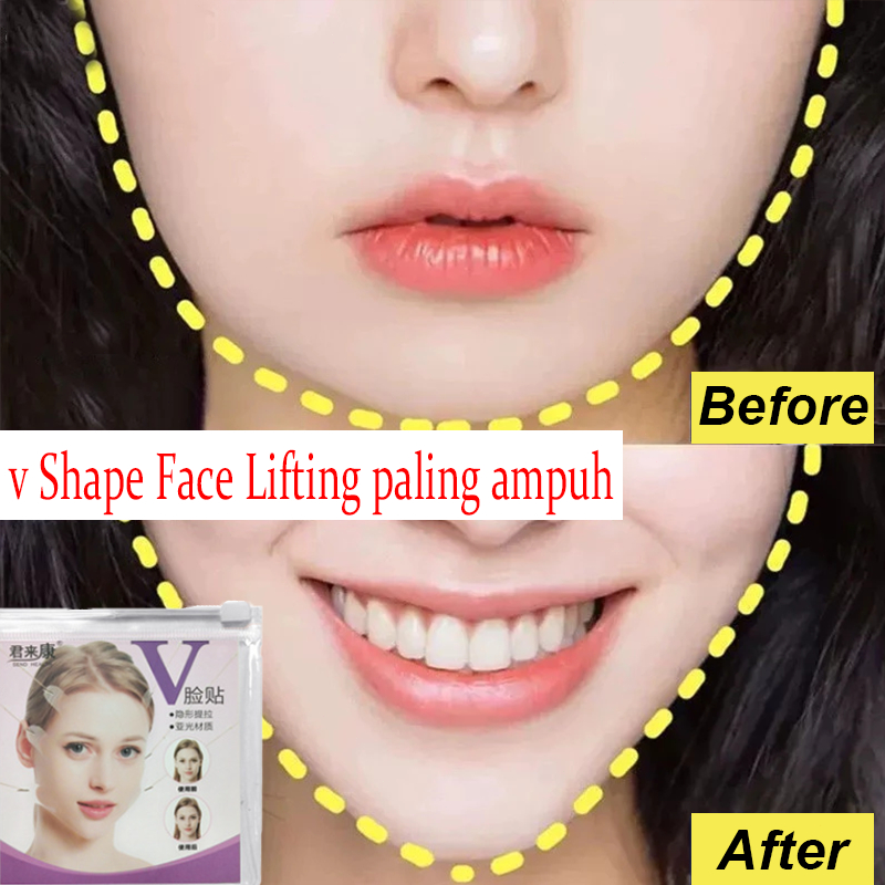 Jual v shape face lifting Penghilang double chin Invisible Instant Face ...