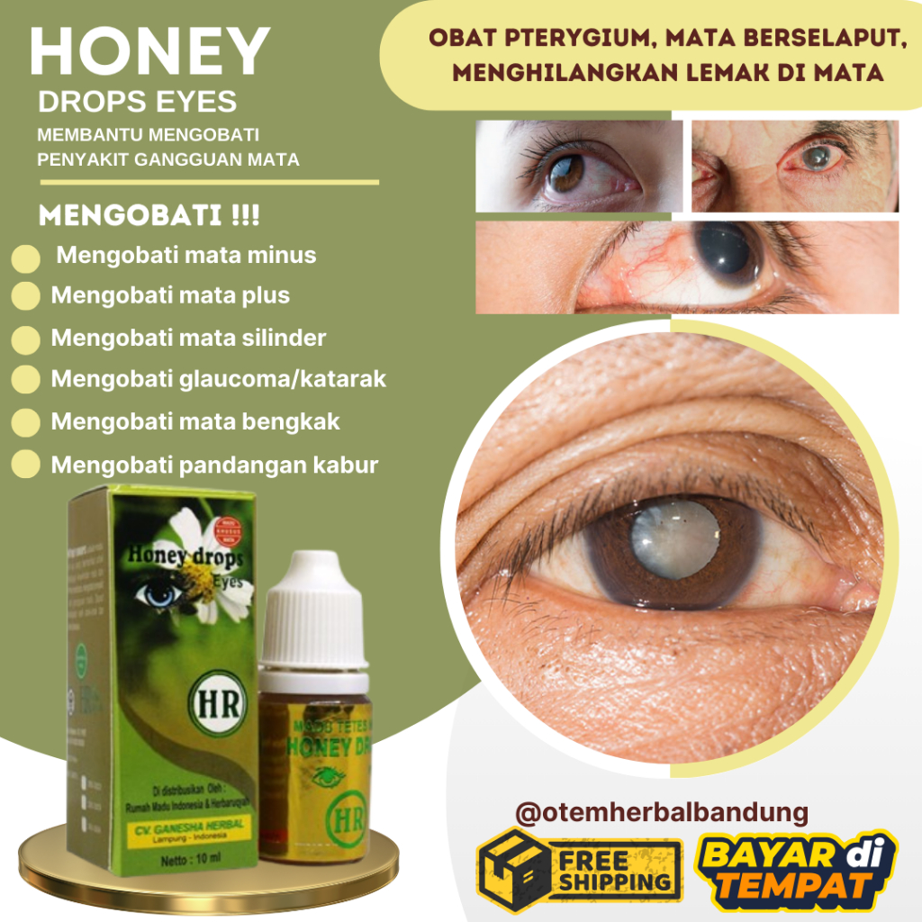 Jual Obat Herbal Honey Drops Eyes – Tetes Mata Katarak, Glukoma ...