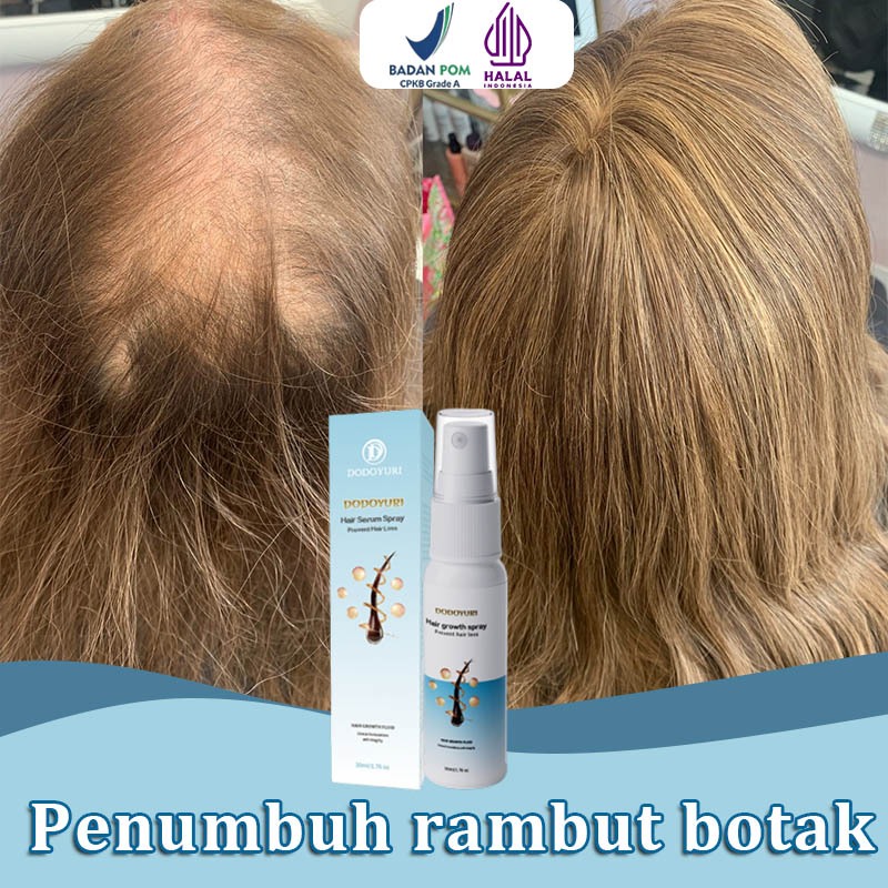 Jual (BPOM)Serum penumbuh rambut Obat penumbuh rambut Penumbuh rambut ...