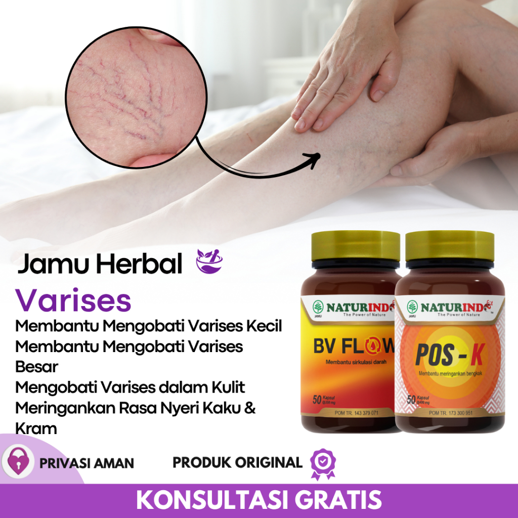 Jual Obat Herbal Varises Farises Otot Kecil Besar Dalam Kulit Nyeri ...