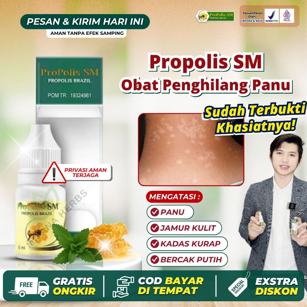 Jual Obat Panu, Penghilang Panu, Obat Panu Anak, Obat Panu Dewasa, Obat ...