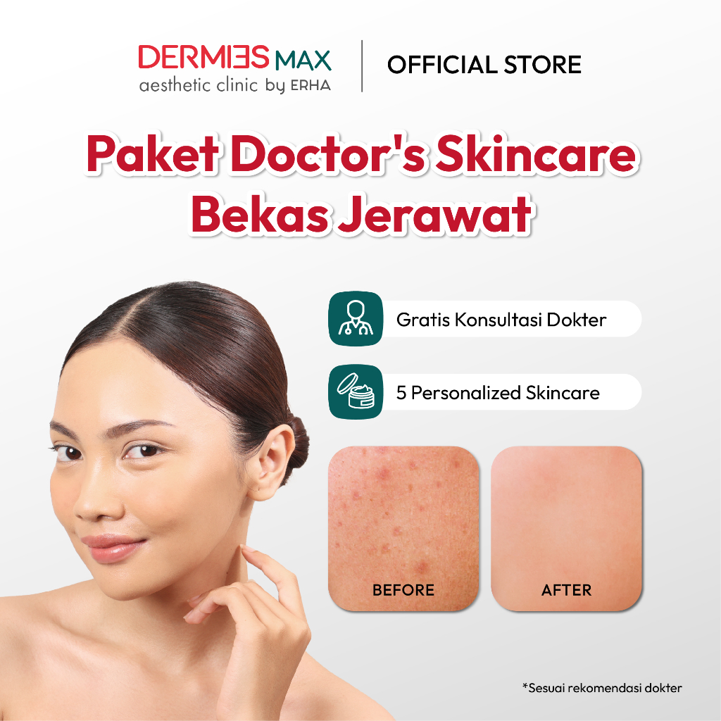 Jual Dermies Max Paket Doctor's Skincare untuk Bekas Jerawat | Shopee ...