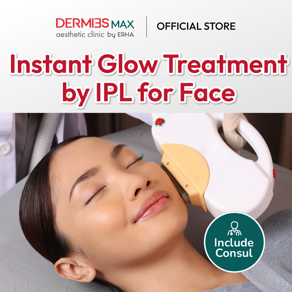 Jual Dermies Max Instant Glow Treatment by IPL (Face) | Shopee Indonesia