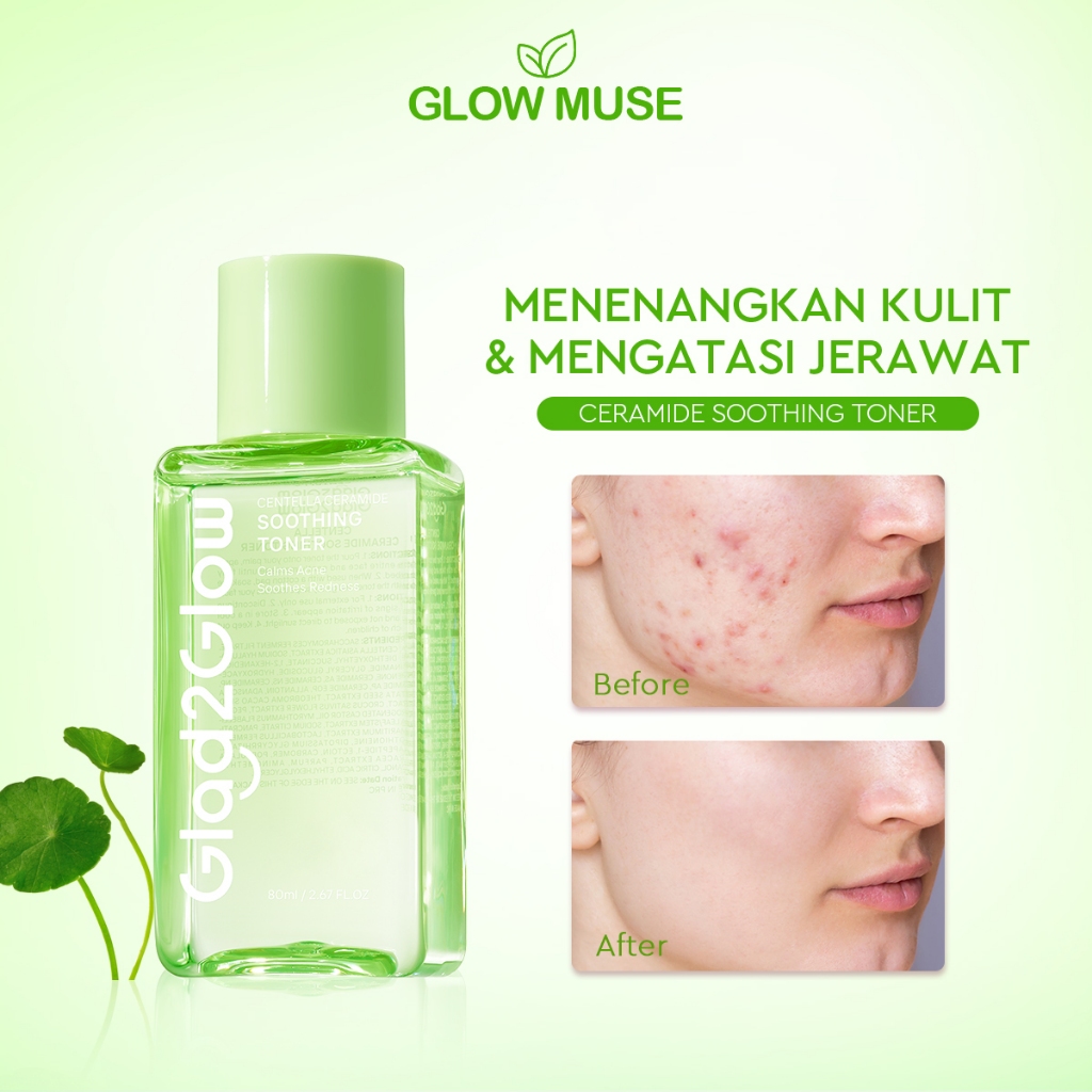 Jual [100% ORI]Glad2Glow Centella Ceramide Super Soothing Toner 80ml | Calms Acnes & Bumps ...