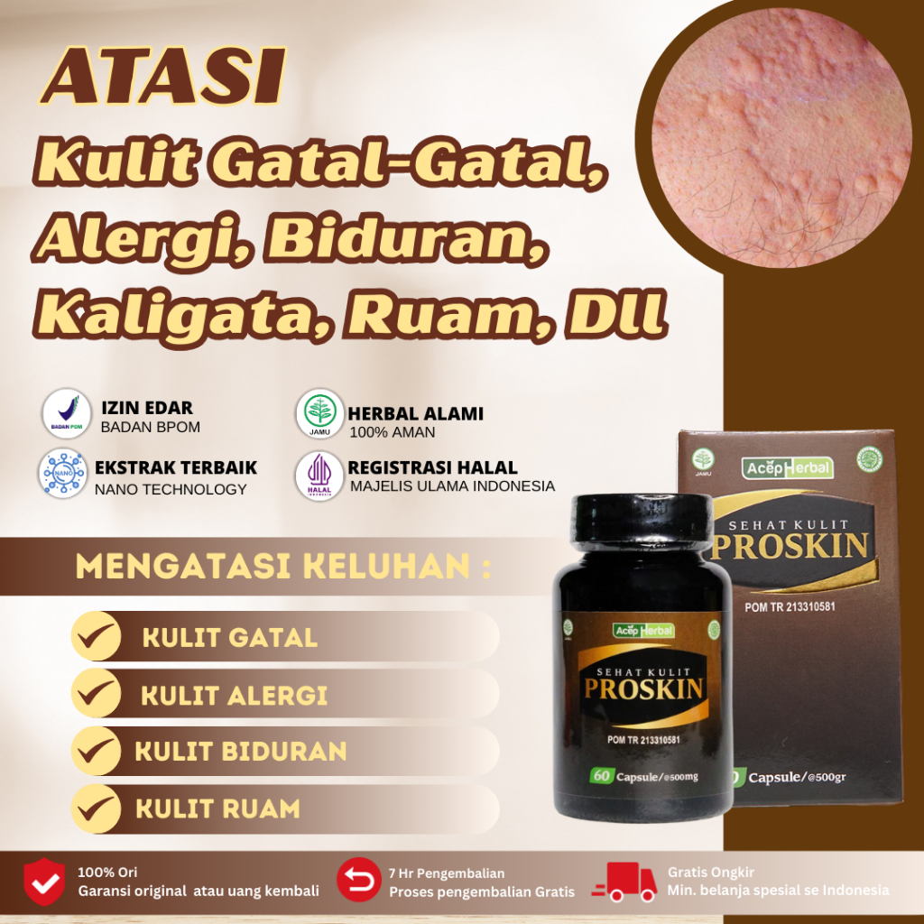 Jual Obat Gatal Kulit Alergi Dingin, Obat Biduran, Obat Gatal Alergi ...