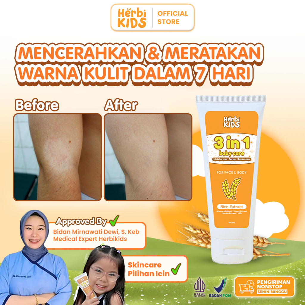 Jual Herbikids 3in1 Face And Body Lotion 100ml Krim Mencerahkan dan ...