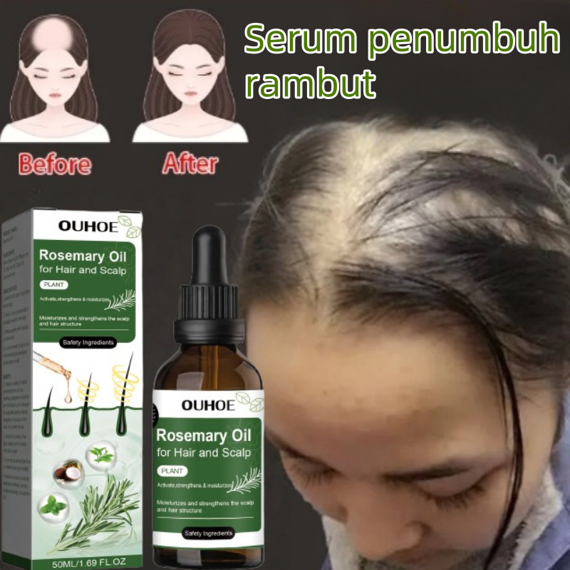 Jual Serum penumbuh rambut penumbuh rambut botak minyak rosemary untuk ...