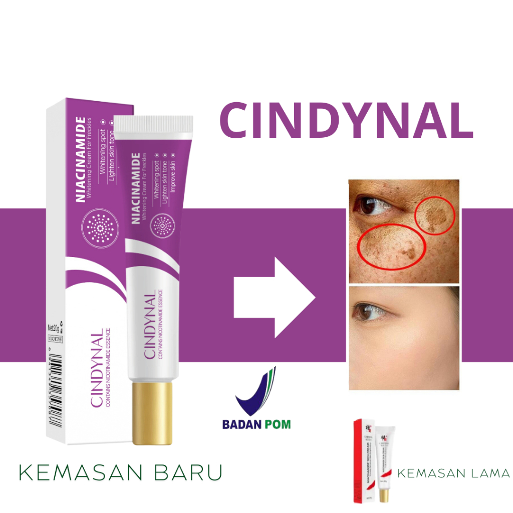 Jual Cindynal Niacinamide Skin Cream Krim Penghilang Flek Hitam Membandel | Shopee Indonesia