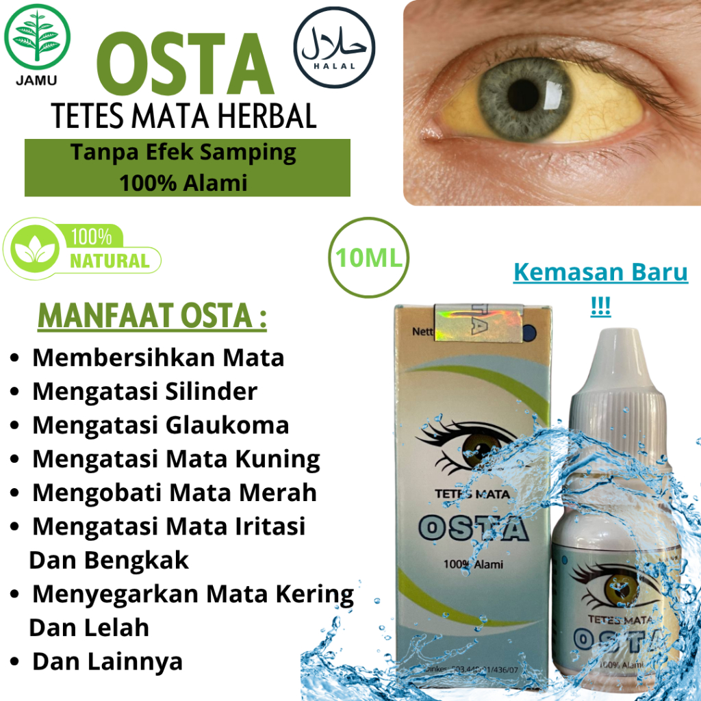 Jual Obat Mata Kuning Paling Ampuh Memutihkan Mata Kuning yang Kotor ...