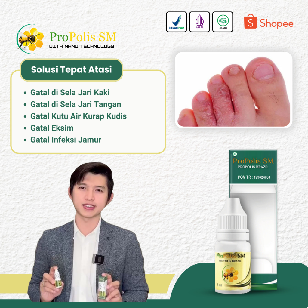 Jual Obat Gatal di Sela Jari Kaki dan Tangan, Gatal Kutu Air Kurap ...