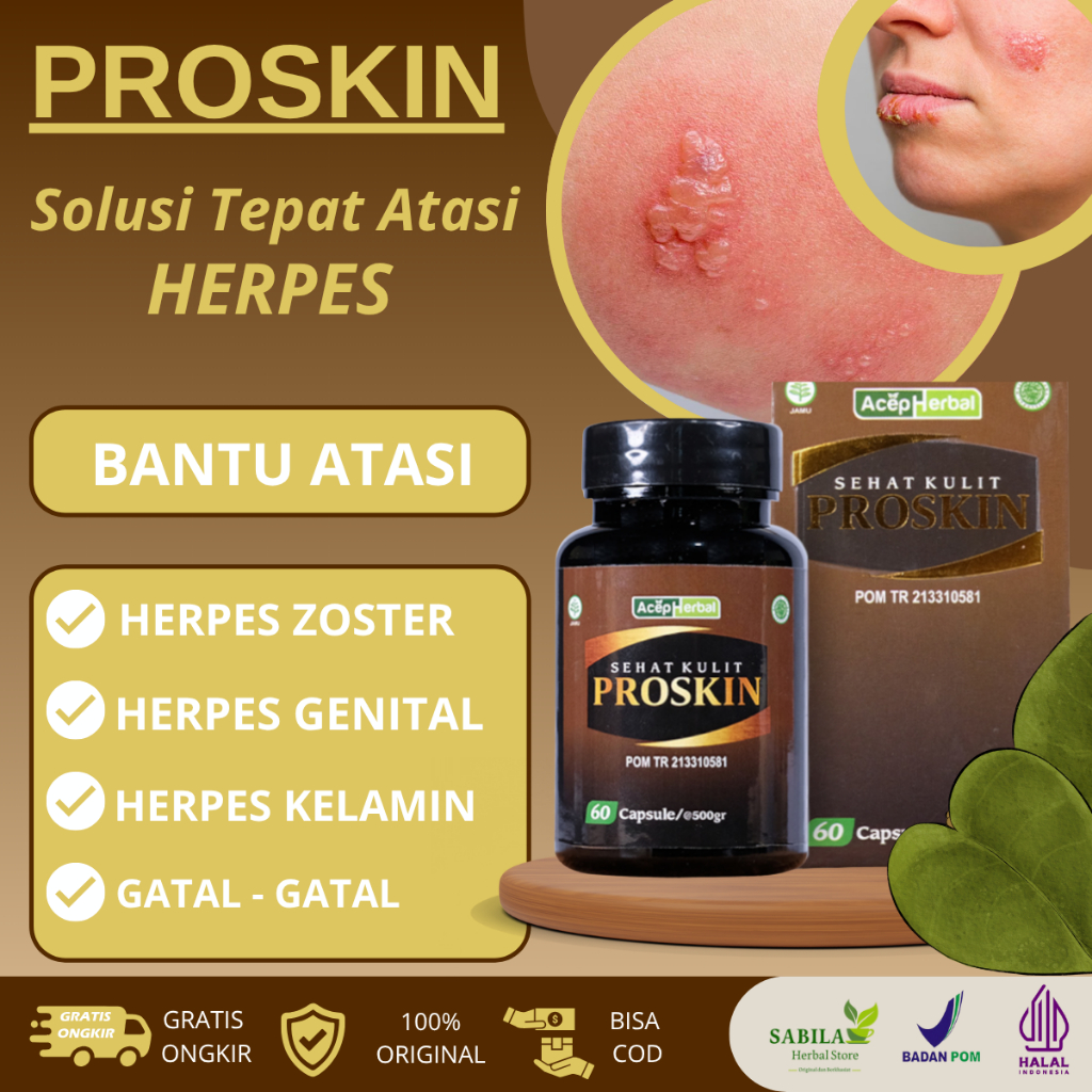 Jual Suplemen Kulit Pereda Gatal - Gatal, Herpes Simpleks, Herpes Kulit ...