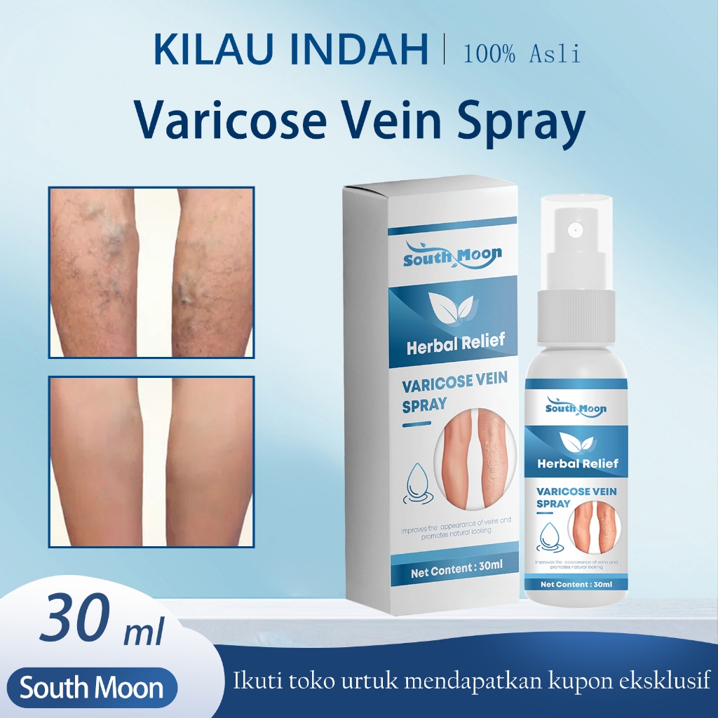 Jual South Moon Varicose Vein Spray 30ml - Spray Vena Varises Kaki ...