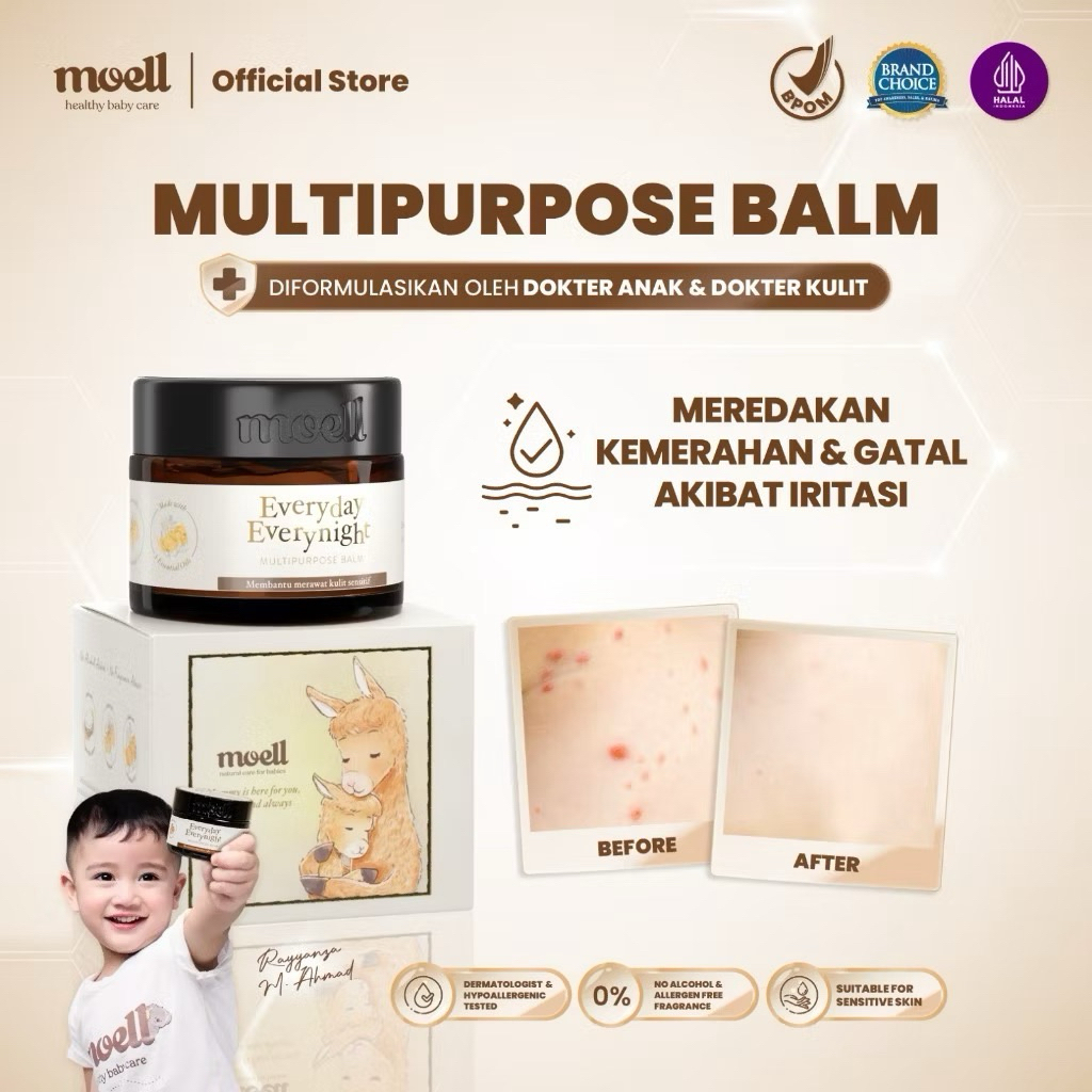 Jual Moell Multipurpose Balm 3in1 - Krim Ruam dan Iritasi Kulit 30gram ...