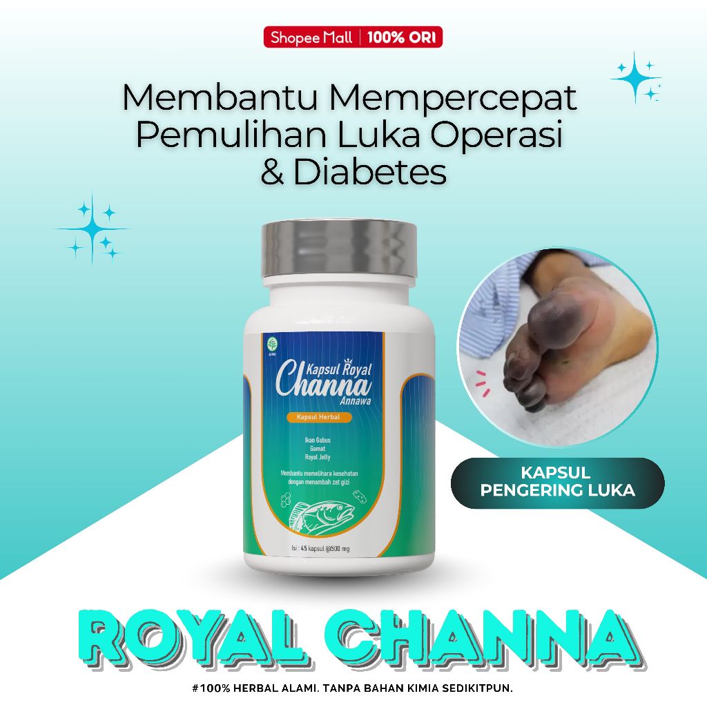 Jual Royal Channa Kapsul Pemulihan Luka Diabetes, Bernanah & Pasca ...