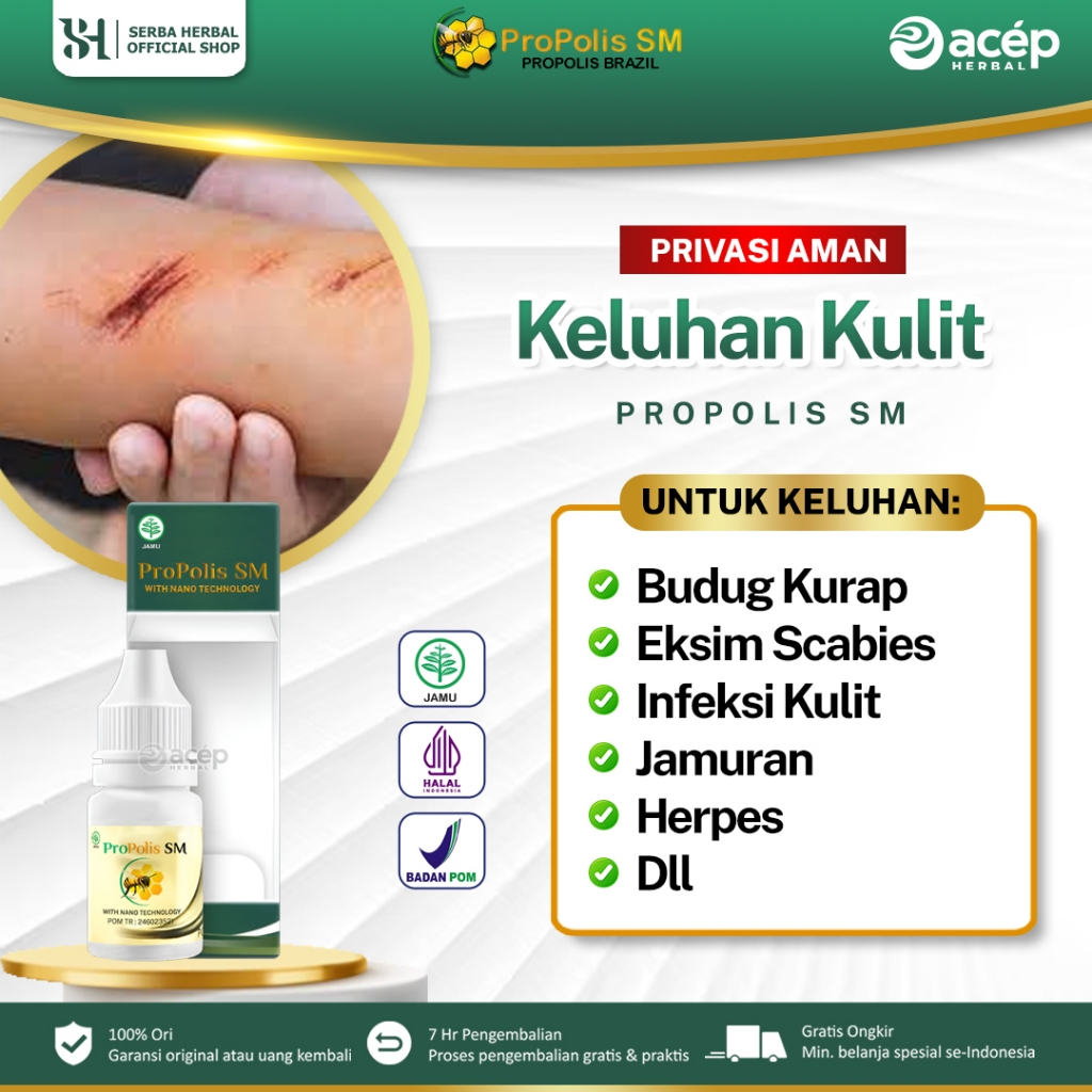 Jual Obat Herbal Gatal Pada Tubuh, Jamur, Basah, Kering dan Bersisik ...