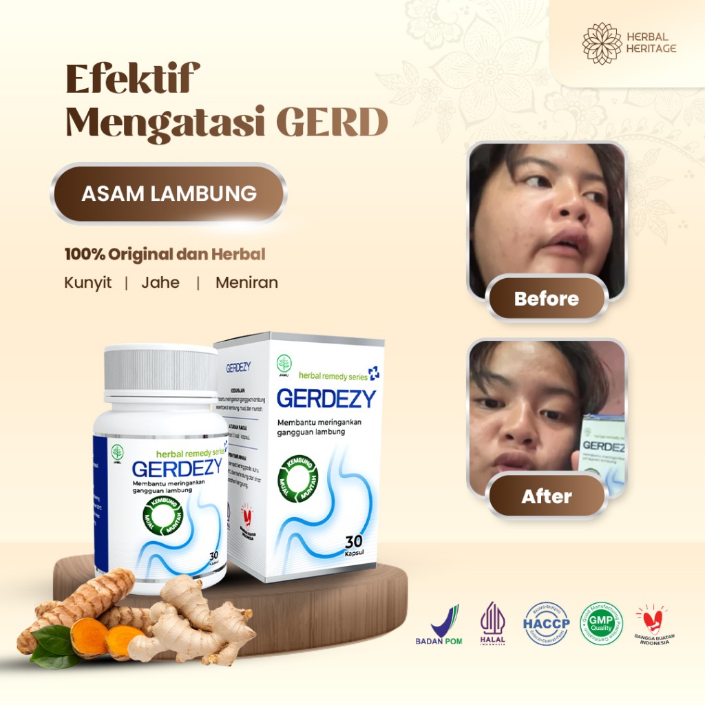 Jual GERDEZY isi 30 Kapsul Herbacore - Obat Asam Lambung Herbal Ampuh ...