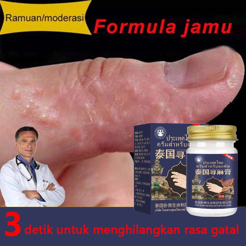 Jual Salep Gatal Paling Ampuh Obat Gatal Paling Ampuh Salep Kulit Gatal ...