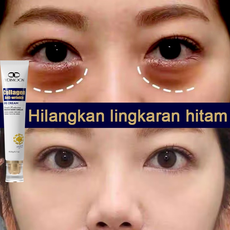 Jual Serum krim mata 20ml Cepat menghilang kantung mata&lingkaran hitam ...