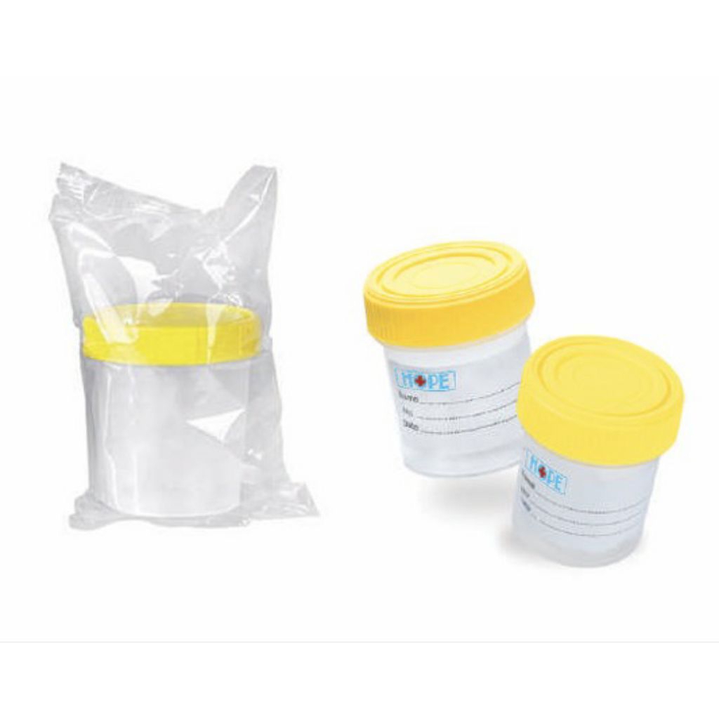 Jual Urine Container – Wadah Sampel Urine Steril | Shopee Indonesia