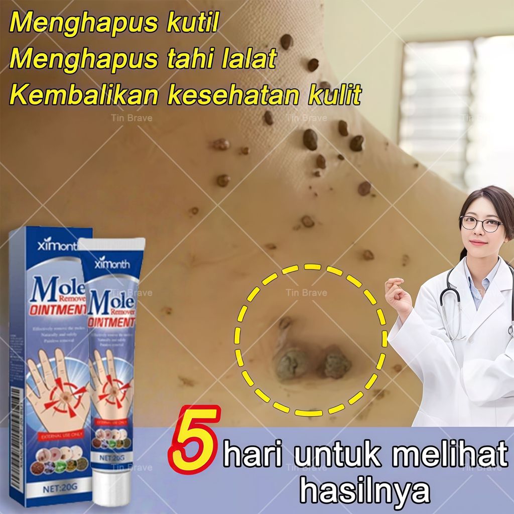 Jual penghilang kutil dan tahi lalat obat kutil ampuh obat penghilang ...