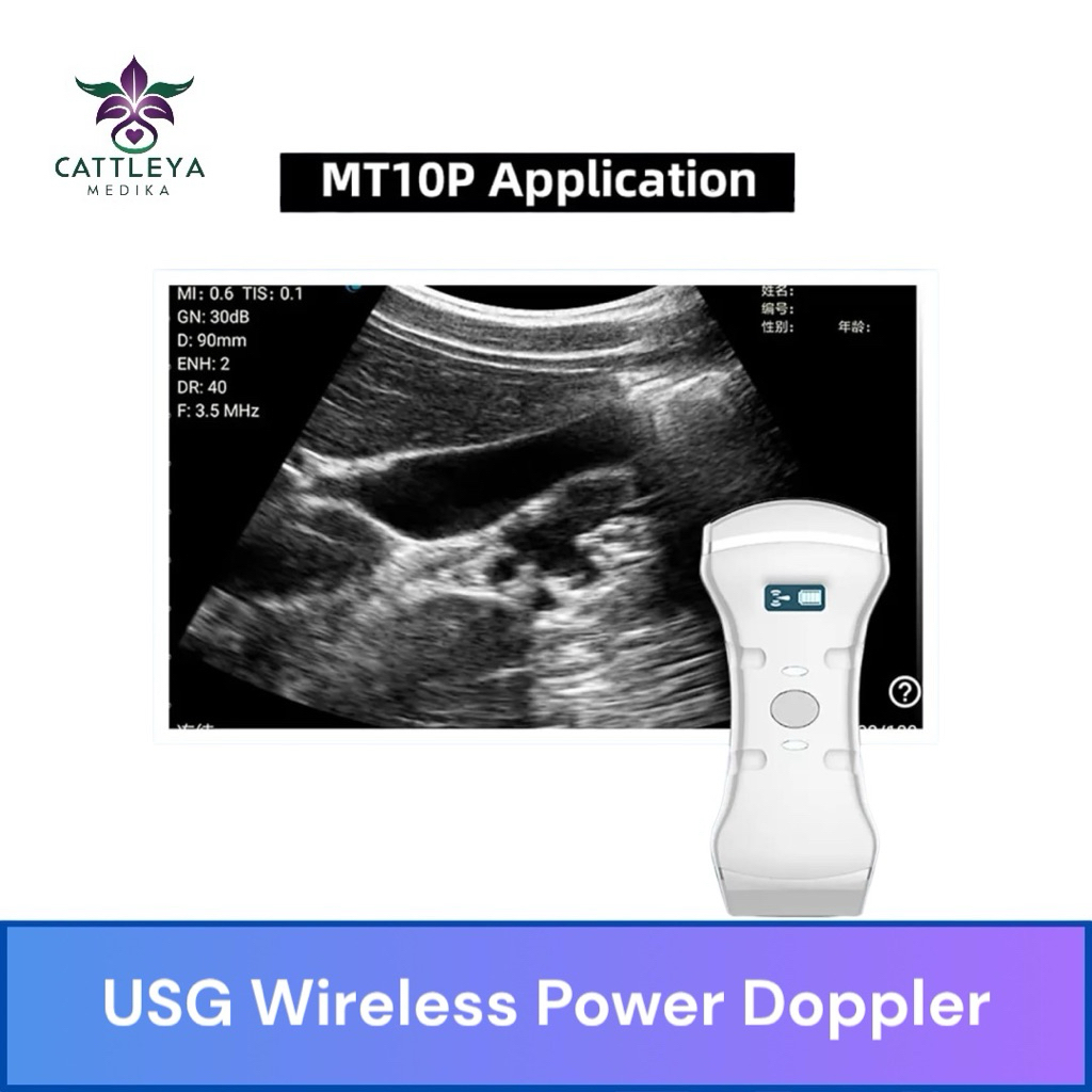 Jual ULTRASOUND | USG Wireless Portable Power Doppler / USG Genggam ...