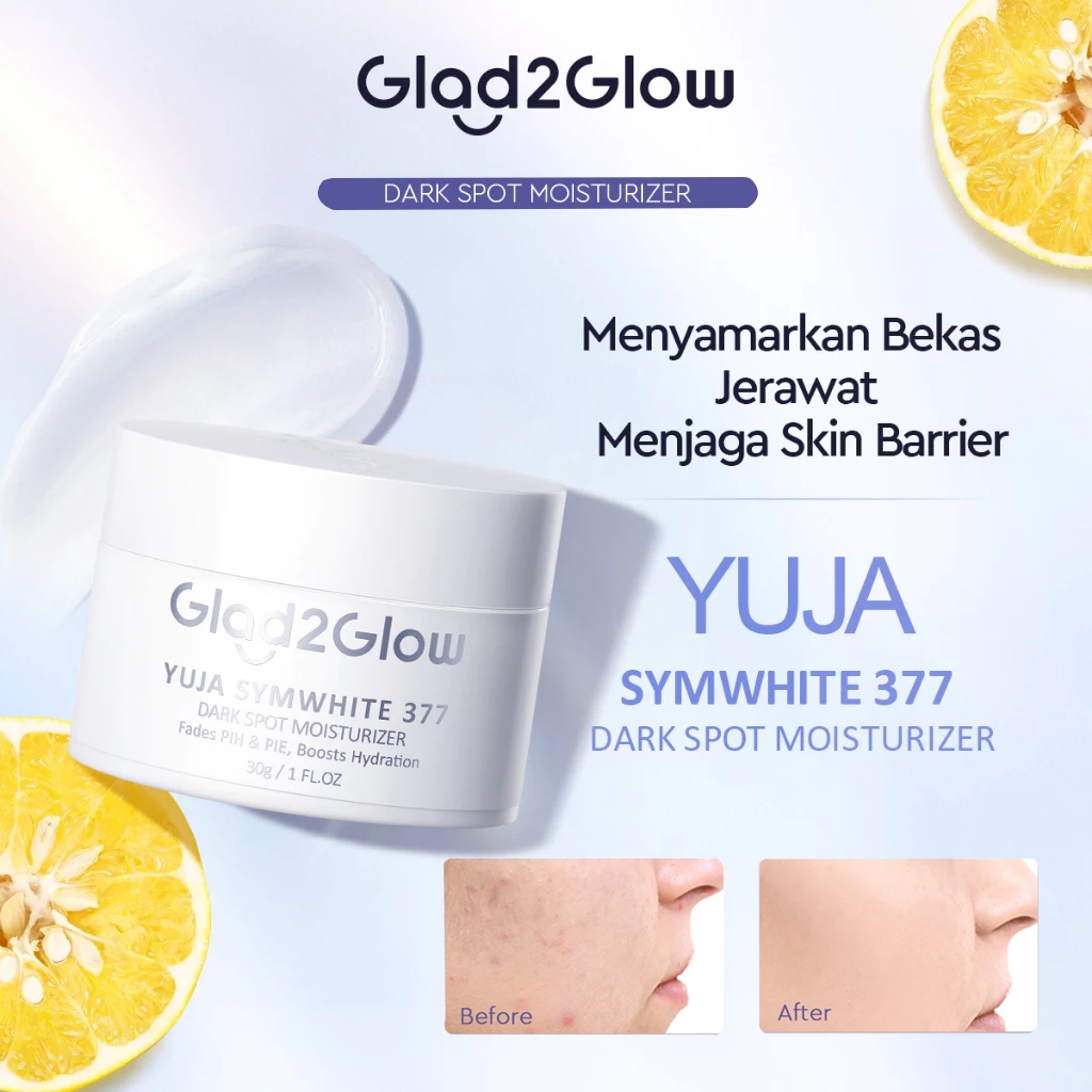 Jual [100%ORI] Glad2Glow Yuja Symwhite 377 Dark Spot Moisturizer | G2G Moisturizer g2g Pelembab ...