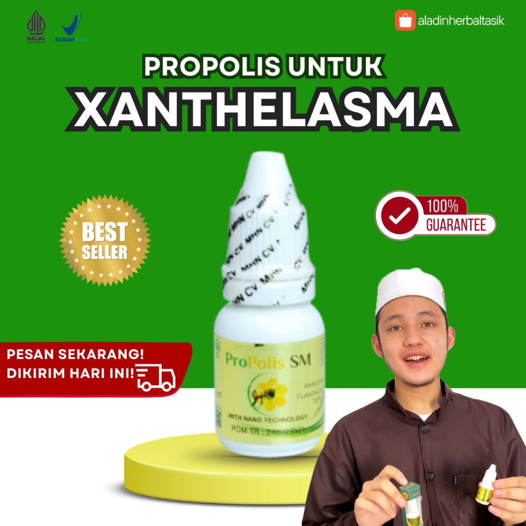 Jual PROPOLIS SM Brazilian 100% Obat Tetes Untuk Atasi Xanthelasma ...
