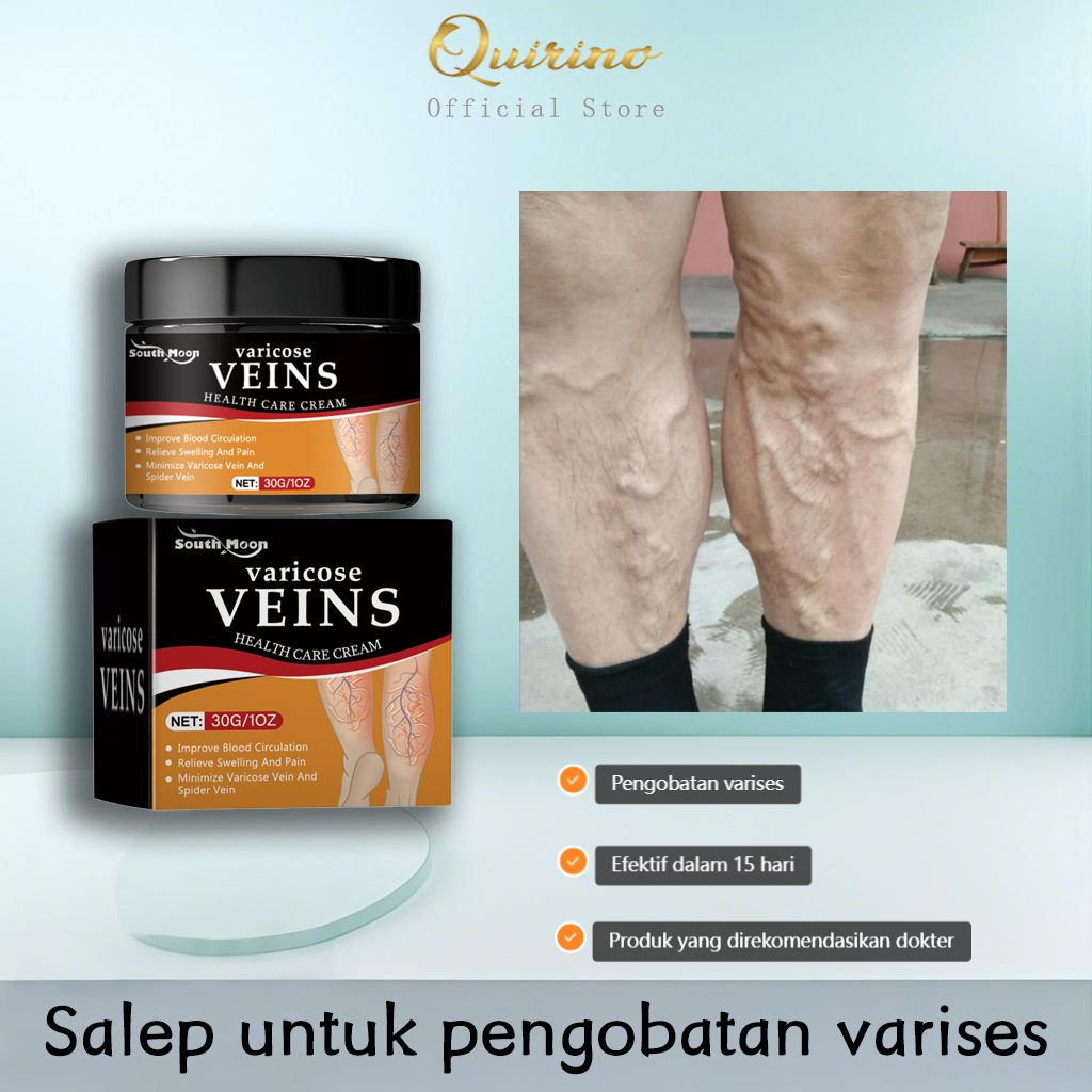 Jual Quirino Obat varises di kaki dan betis paling ampuh Obat varises ...
