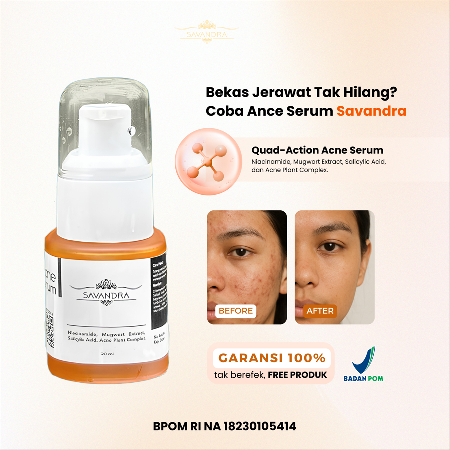 Jual Savandra- Anti Acne 20ml - serum wajah untuk merawat kulit ...