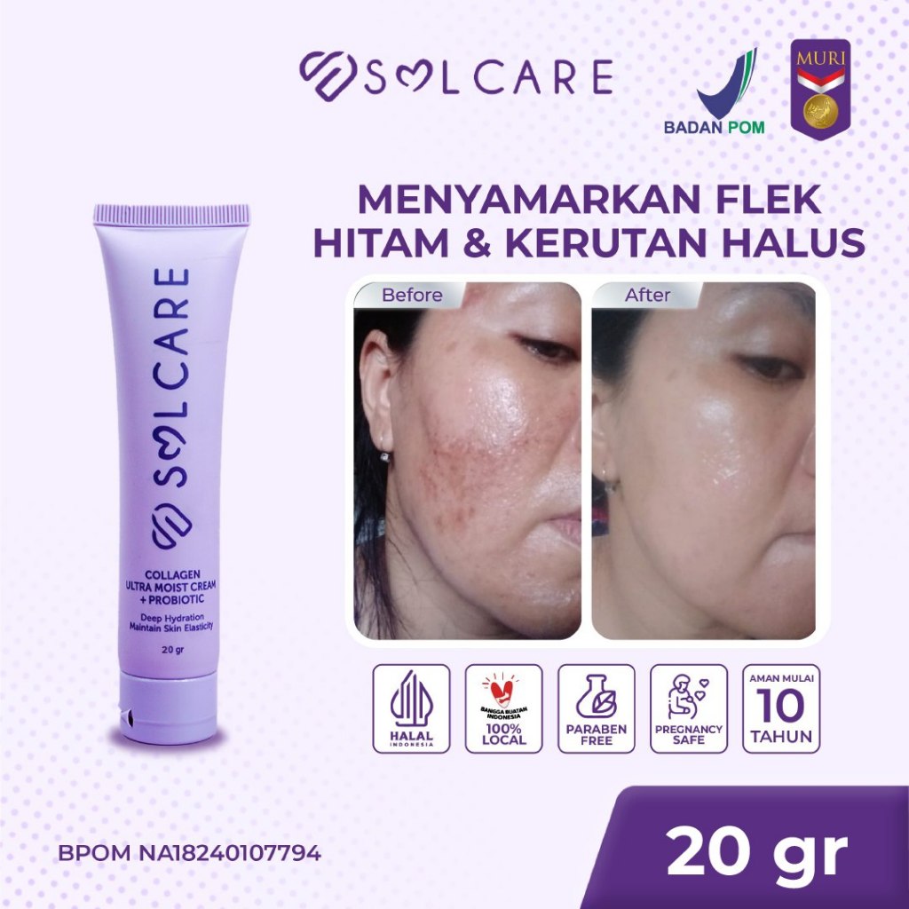 Jual BELI 1 DAPAT 10 Solcare Collagen Ultra Moist Cream + Probiotic ...