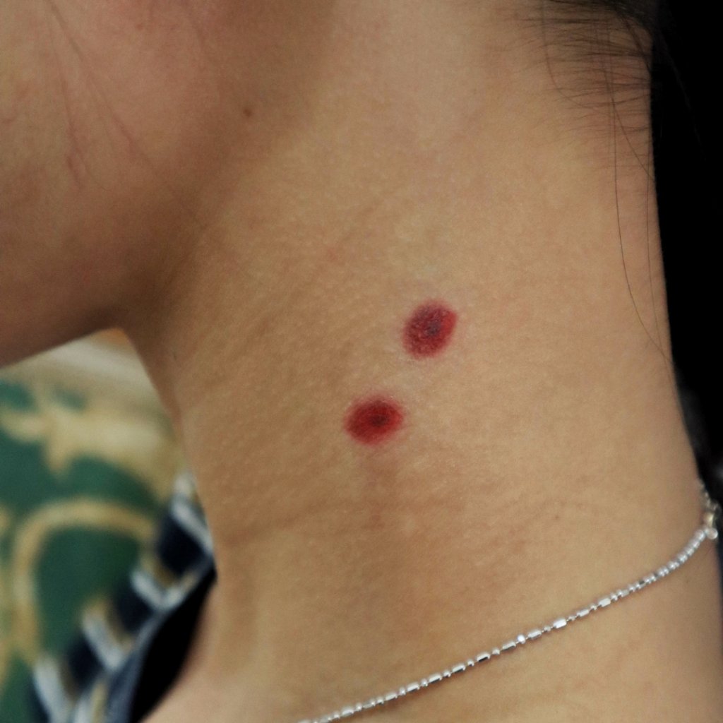 Jual [PRODUK LOKAL] TEMPORER TATO LUKA GIGITAN VAMPIR | VAMPIRE BITE ...