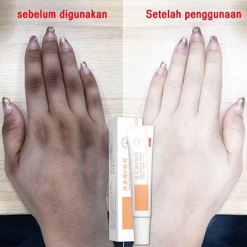 Jual hand body pemutih whitening body cream vitamin e pemutih tangan ...